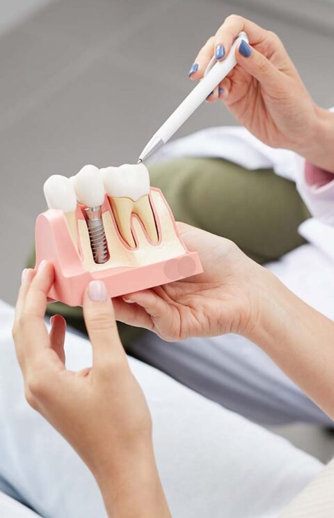 Dental Implant Placement - Precision Periodontal and Implant Center